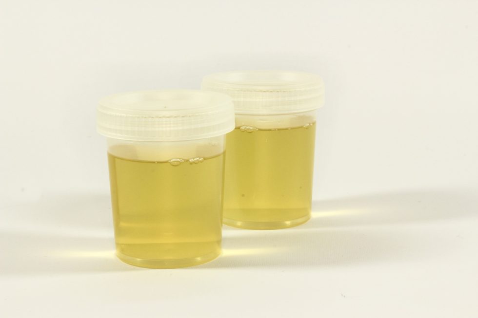 Urine Drug Testing NZ & AU | Mobile Urine Testing | TDDA